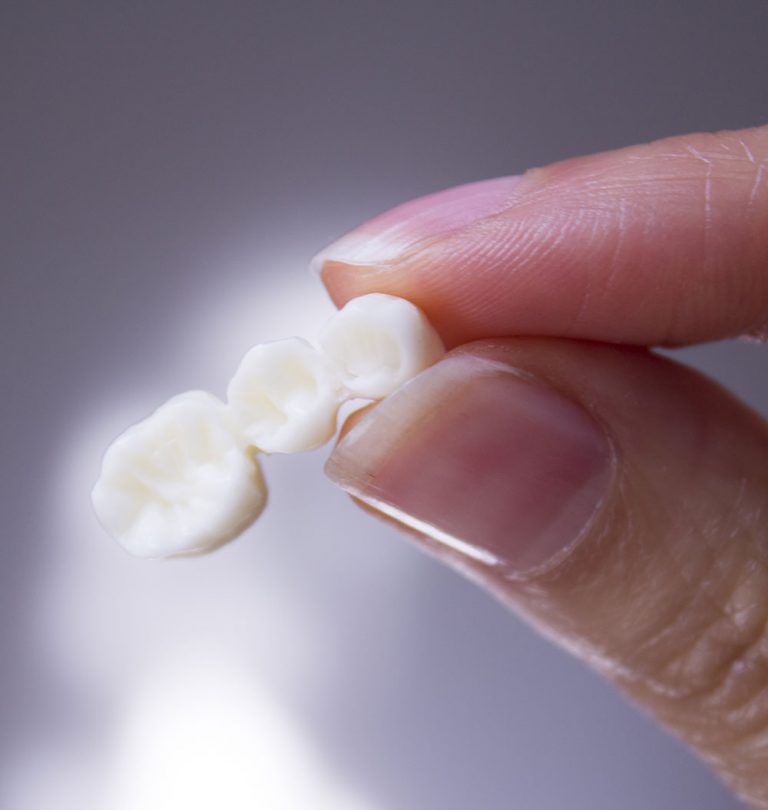 If you have missing teeth, visit Dr. Jacqueline Subka for dental ...